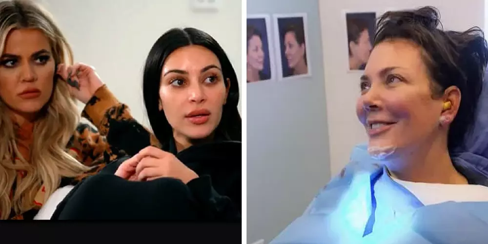 Kris Jenner fik udført arbejde på sine øreflipper og 15 andre berømtheder, der er store #PlasticSurgeryFails 13156_2