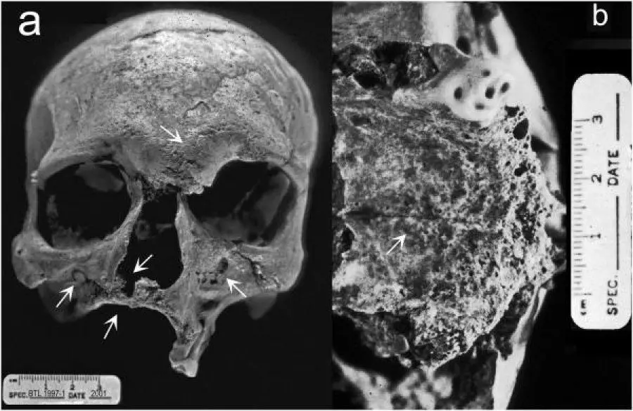 15 Vedîtinên Arkeolojîk ên Mysterious Di Seranserê Dîrokê de 19036_5